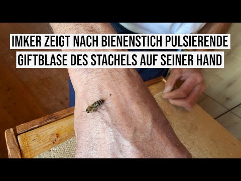 #Imker Georg zeigt nach #Bienenstich die pulsierende Giftblase des Stachels auf seiner Hand #Imkerei