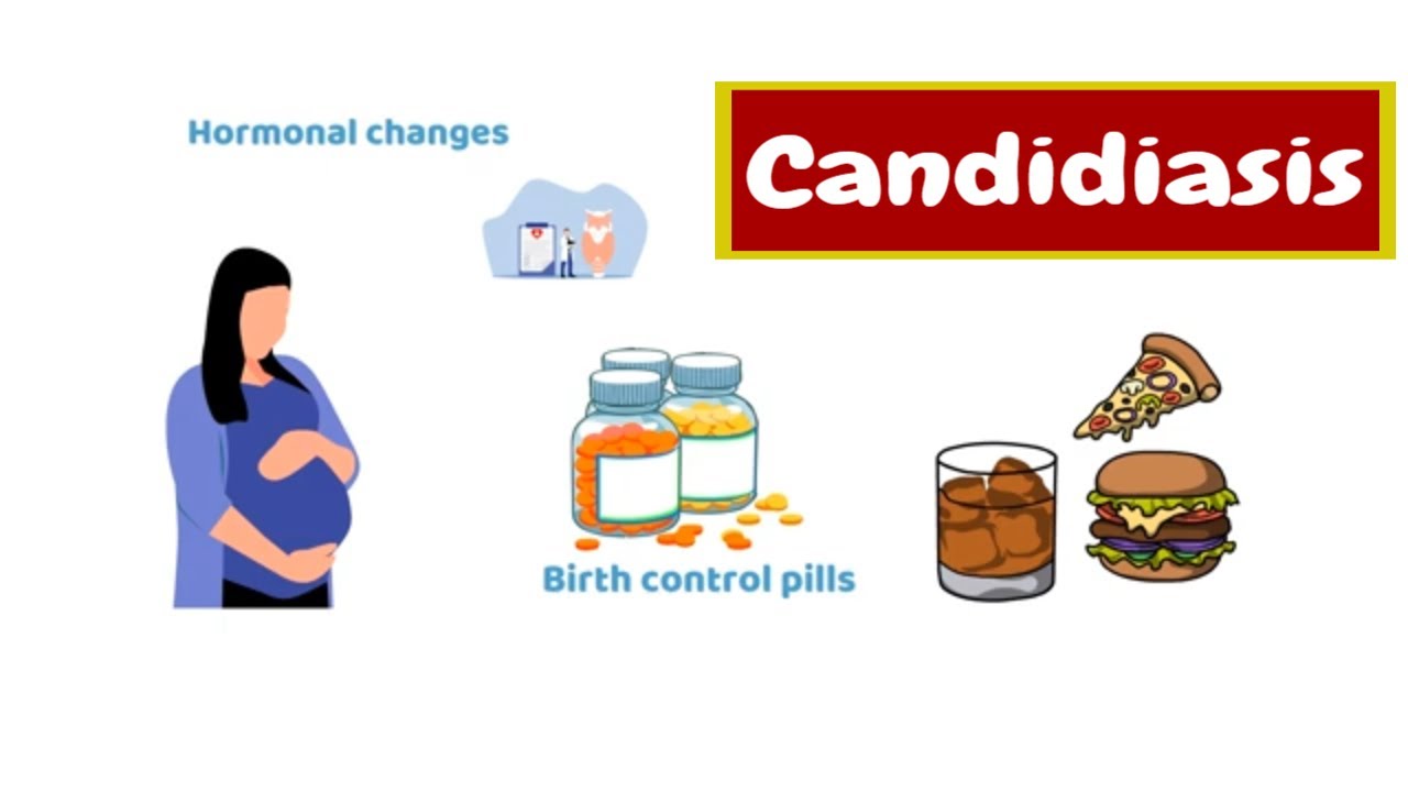 Candidiasis [Causes, Symptoms, Diagnosis and Treatment] - YouTube