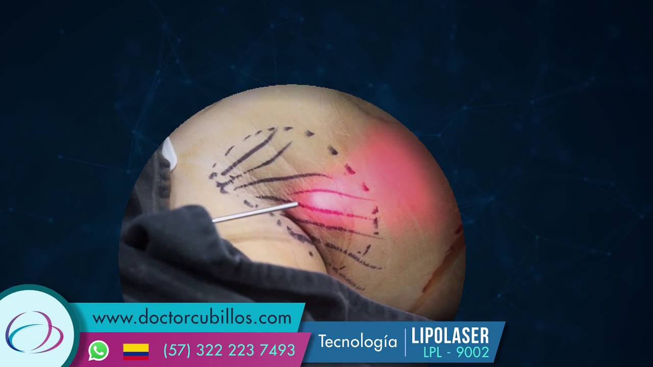 Péxia Mamaria - YouTube