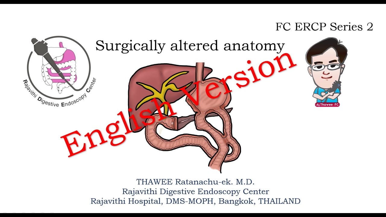 FC ERCP Series 2 Surgically altered anatomy English version - YouTube