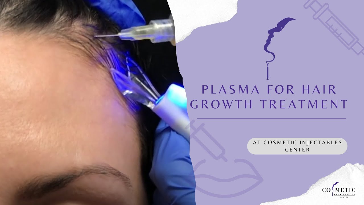 Plasma For Hair Growth Treatment - YouTube