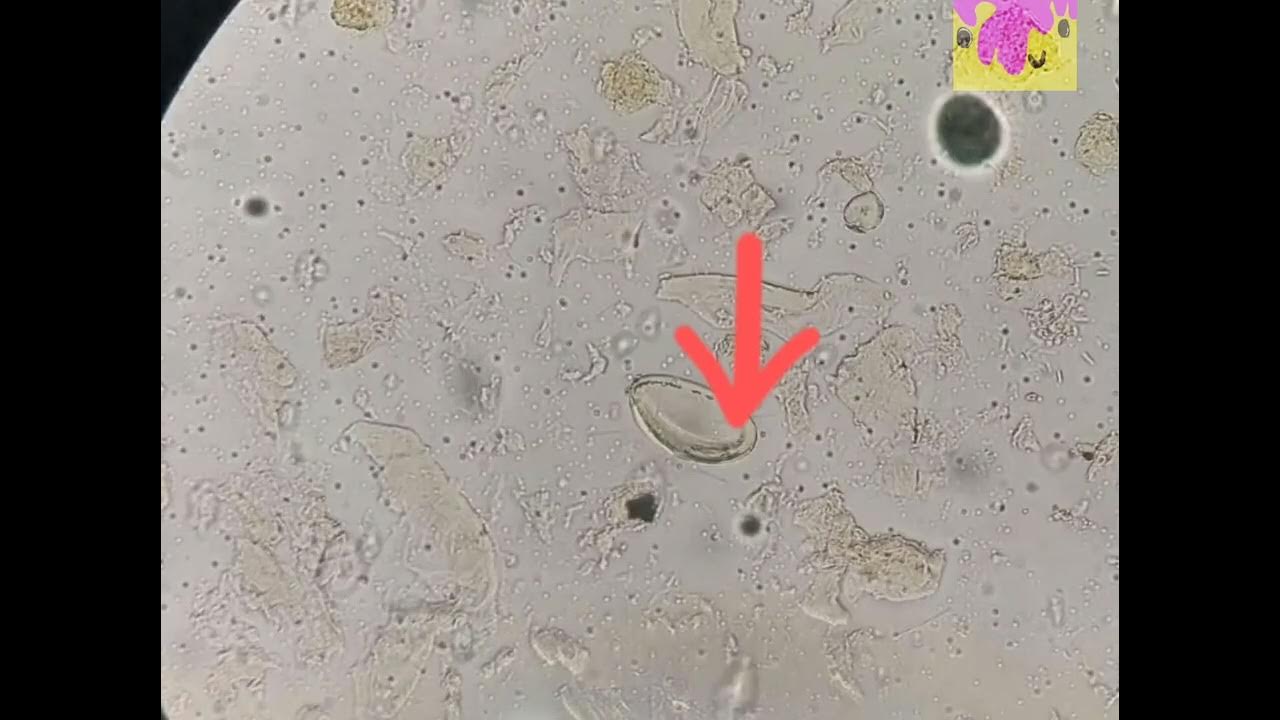 Enterobius vermicularis - YouTube