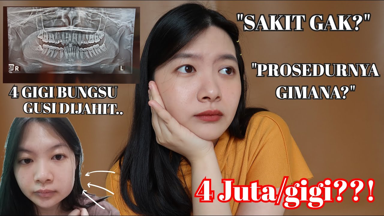 Pengalaman Operasi Gigi Bungsu🦷🦷 | Ester Wijaya - YouTube
