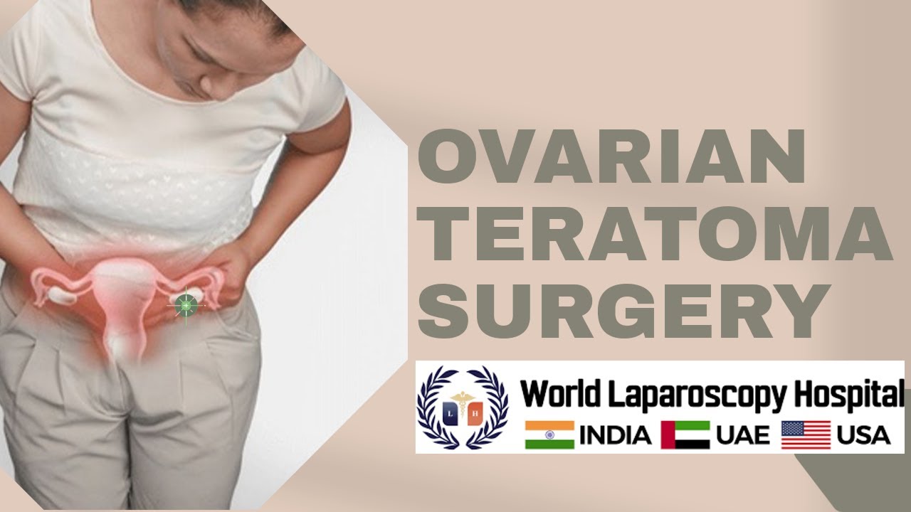 Laparoscopic Removal of Ovarian Teratoma - YouTube