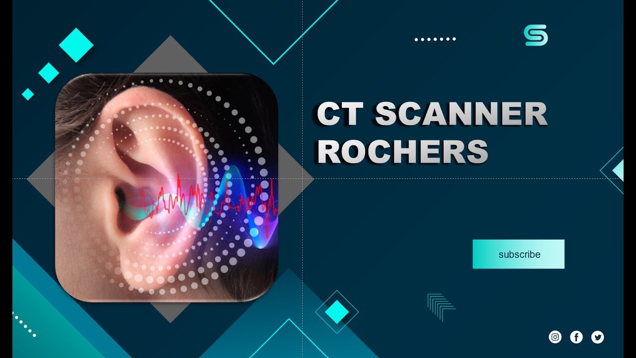 CT SCANNER ROCHERS - Partage de pratique - YouTube