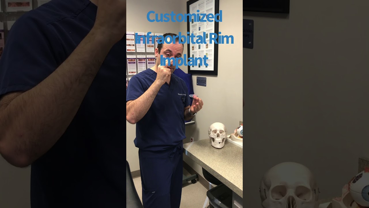 Customized Infraorbital Rim Implant-- Dr. Mehryar Taban-- CALL 310-299 ...