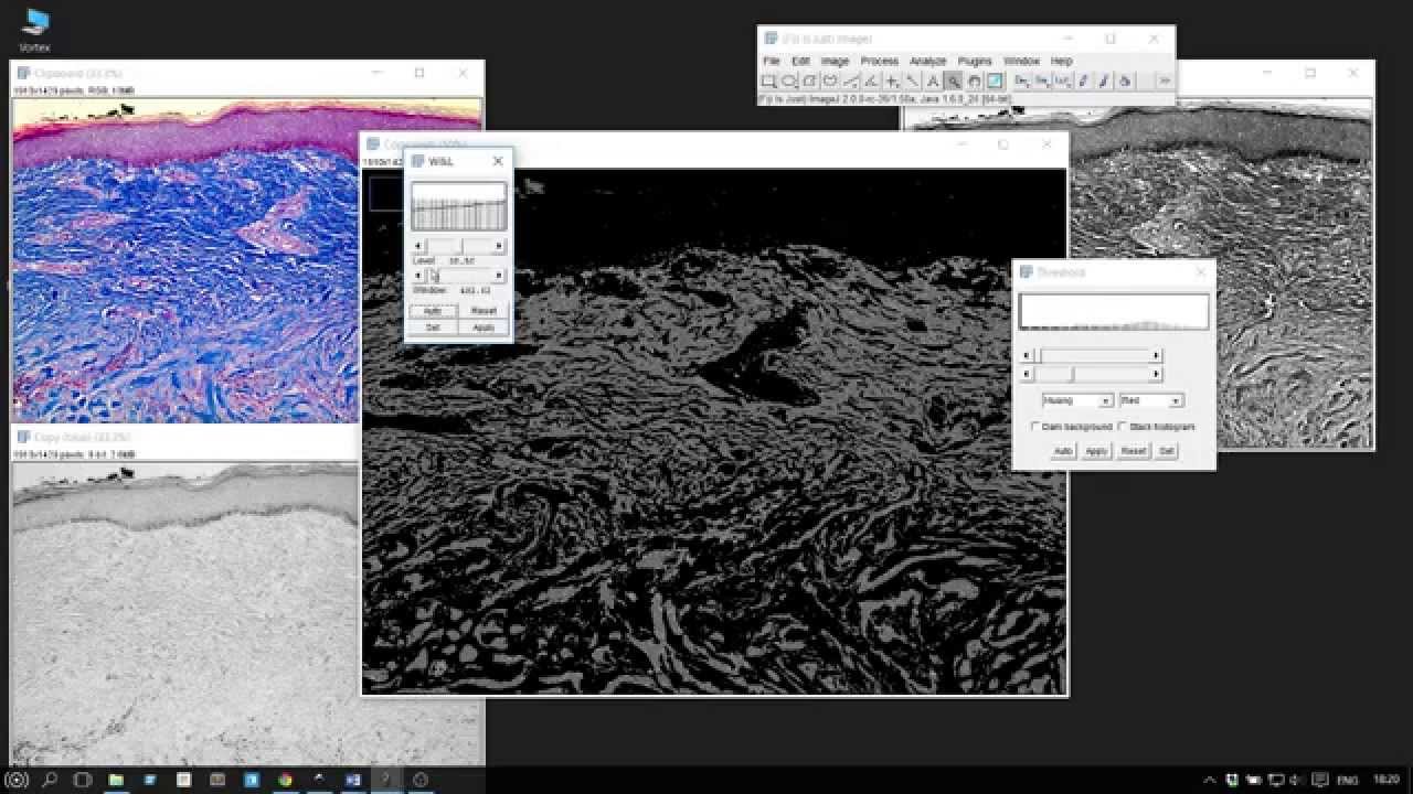 Imagej Measuring Areas Of Histological Sections Youtube