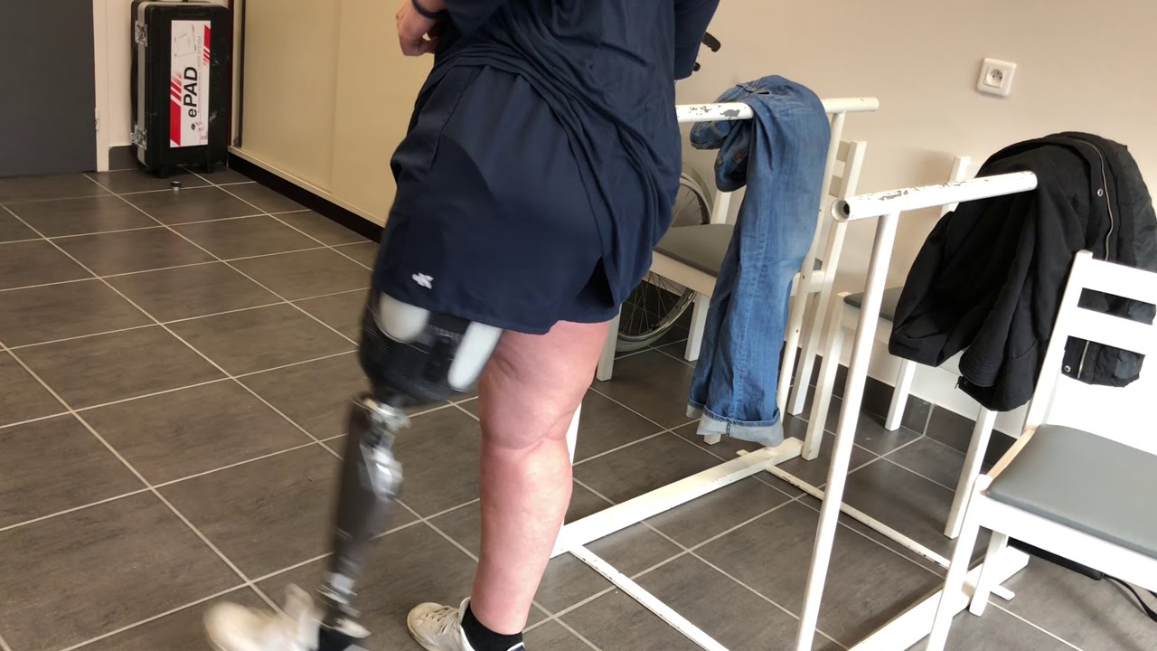 Fractal Black: High Fidelity prosthetic Socket with Boa System - YouTube