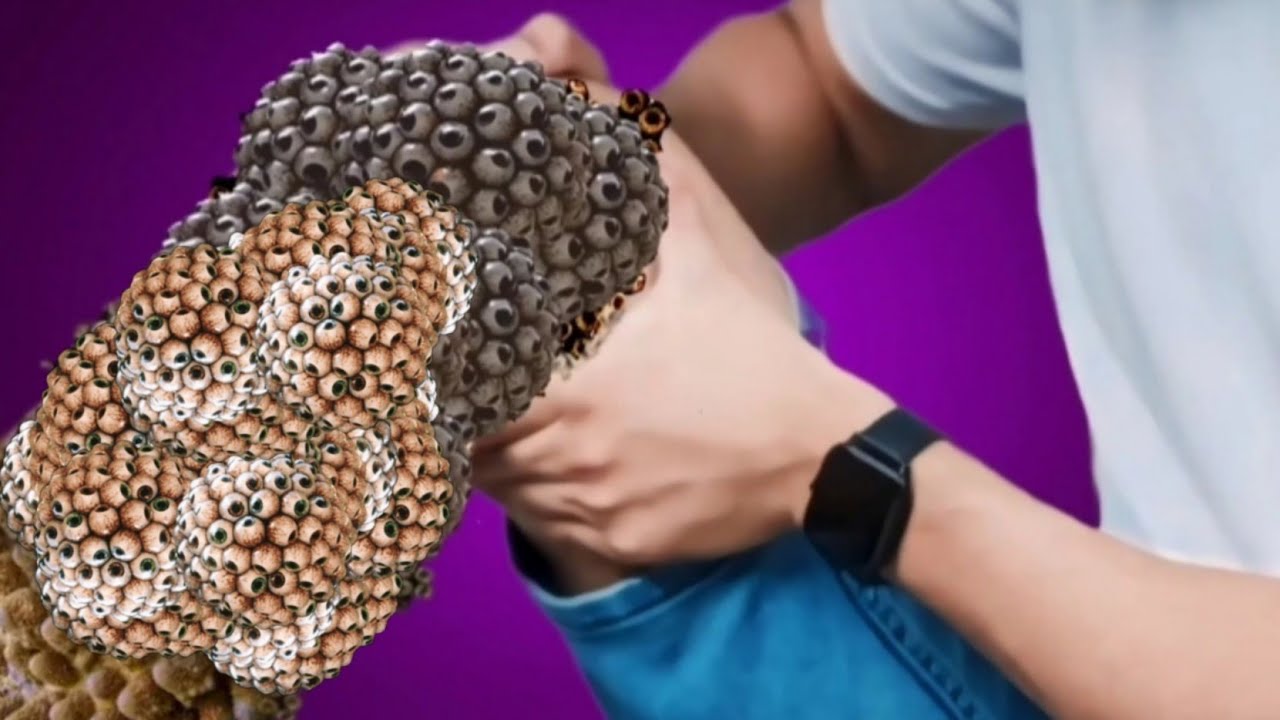 ASMR Animation Treatment 2D Infected 🚑 Legs,, 2D Leg Treatment ...