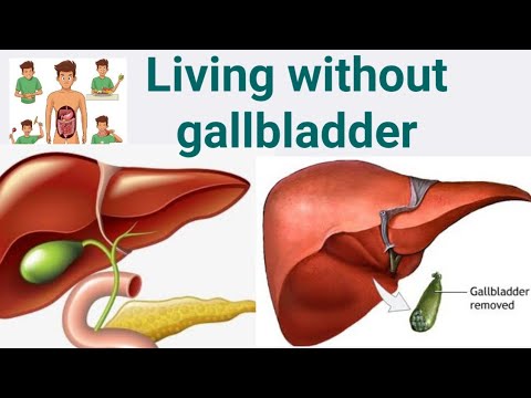Can we live without gallbladder ? - YouTube