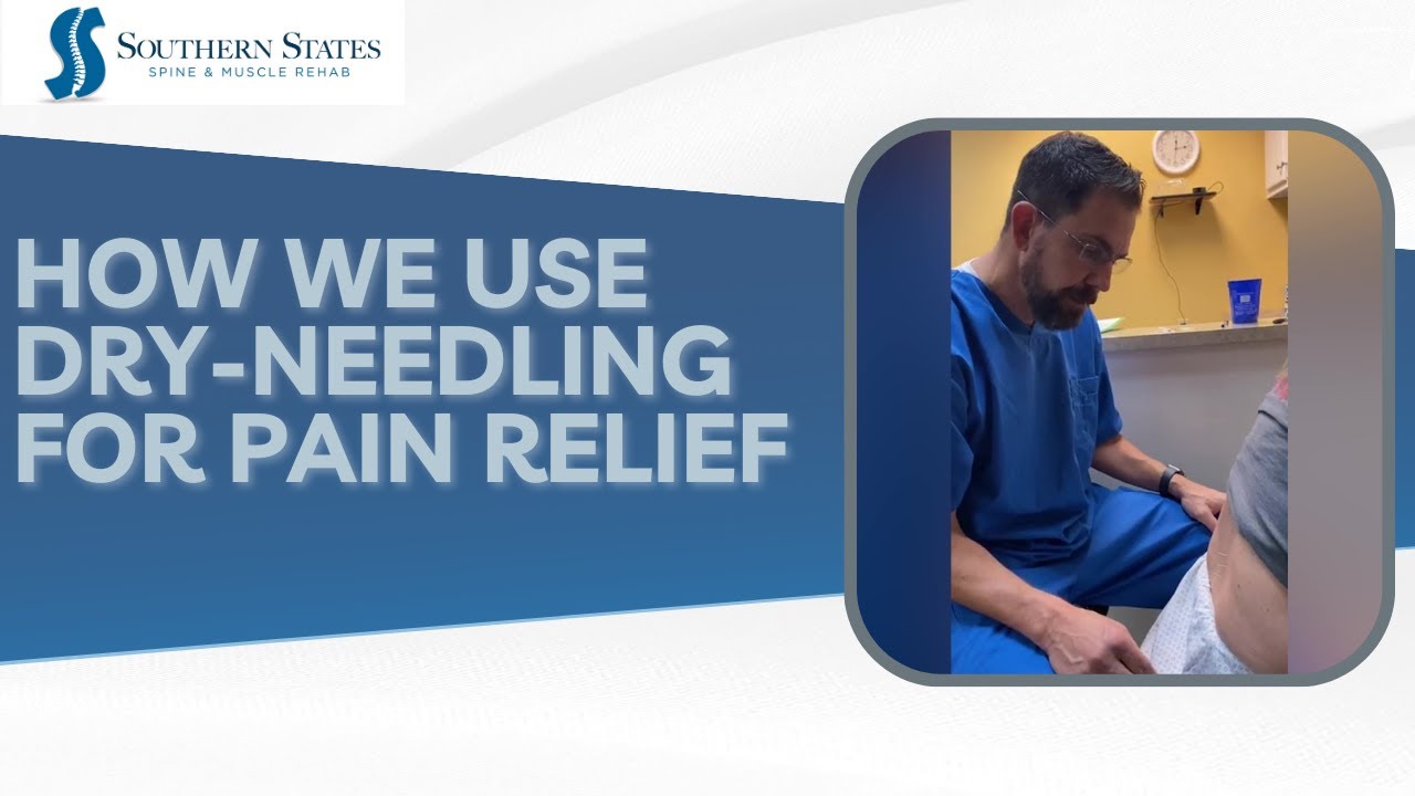 How We Use Dry Needling For Pain Relief / Southern States Spine ...