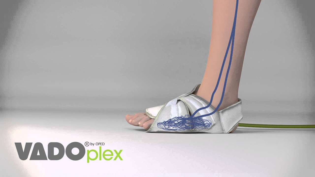 VADOplex System: Function in the wound and vessel areas | VADOplex ...