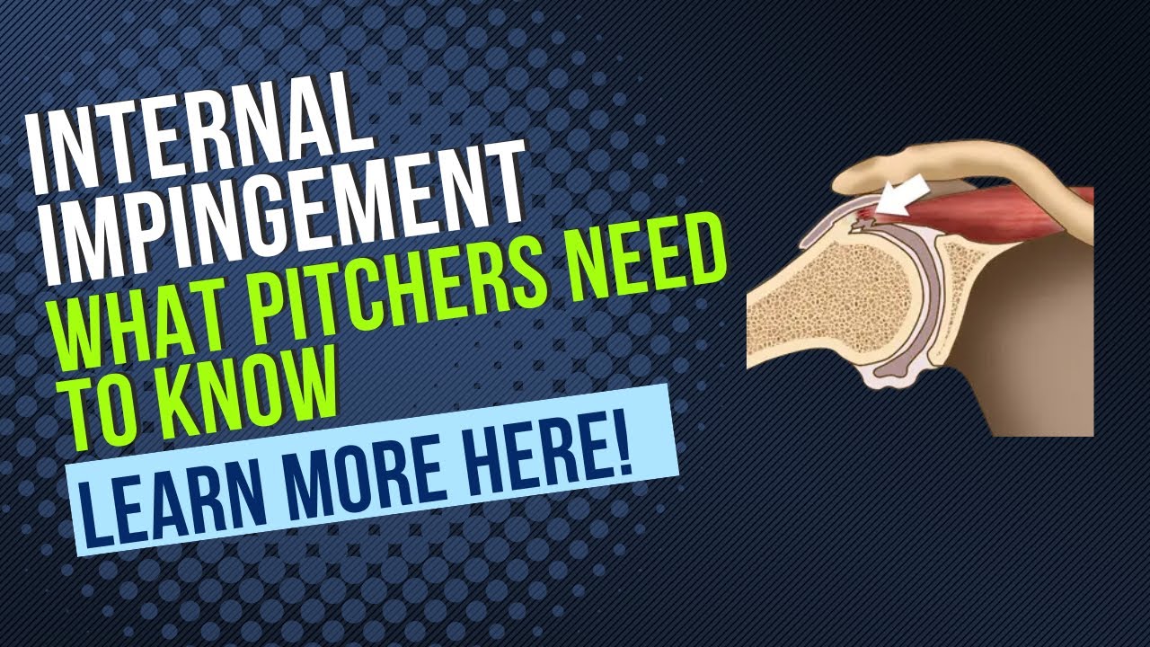 How to Identify Internal Impingement In Pitchers - YouTube
