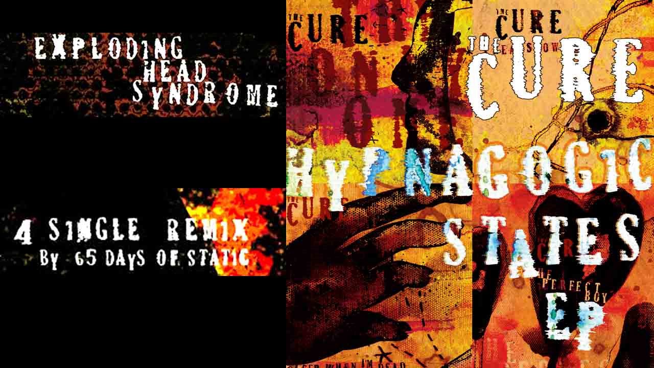 THE CURE 🎵 Exploding Head Syndrome 🎵 4 Single MIX ♬ HQ AUDIO - YouTube