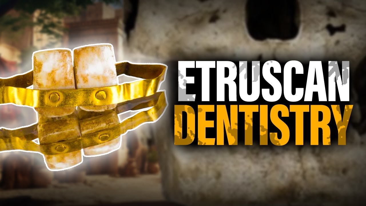 3,000-Year-Old Dental Work? Etruscans Did It First! - YouTube