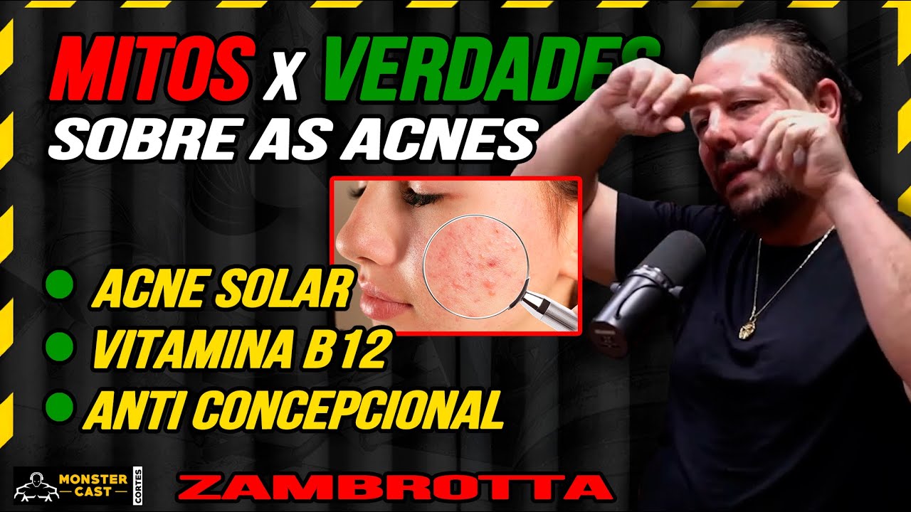 MITOS E VERDADES QUE O POVO ACREDITA SOBRE ACNES E ESPINHAS ! | ZAMBROTTA - YouTube