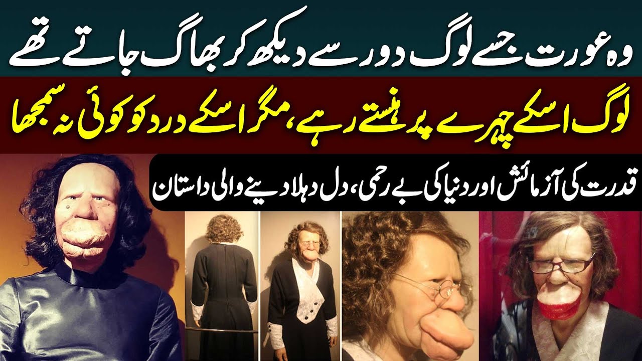 Emotional Story of Grace Mcdaniels | The Mule Faced Woman | Haqeeqat ...