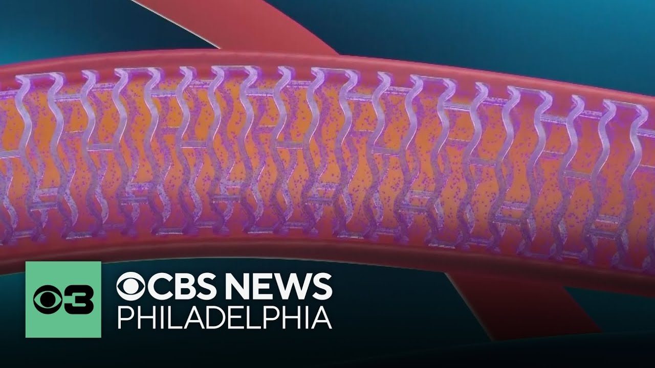 Cutting-edge new device made to help millions suffering with peripheral ...