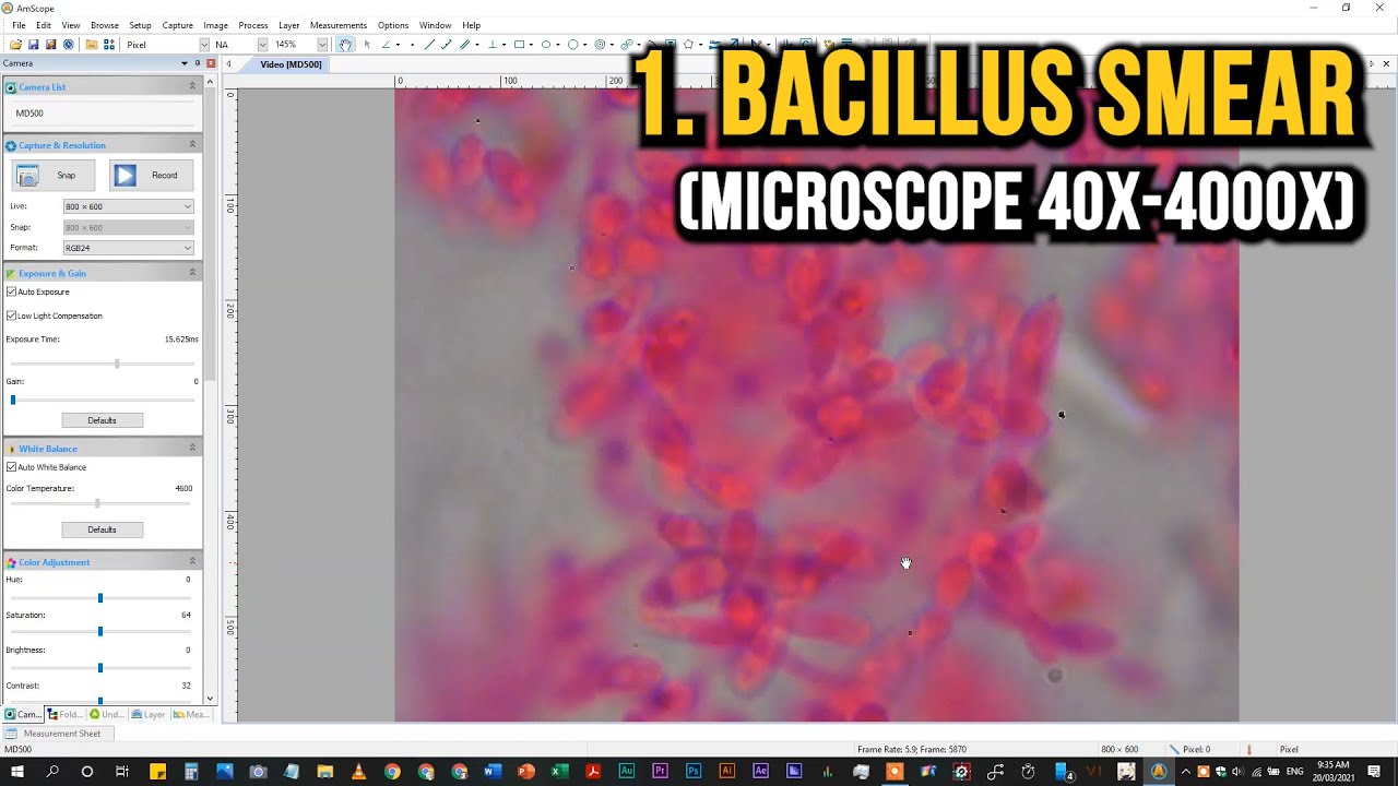 1. Bacillus Smear (Microscope 40x 4000x) - YouTube