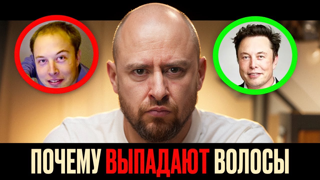 ВЫПАДЕНИЕ ВОЛОС Реальные причины Алопеция Как восстановить рост