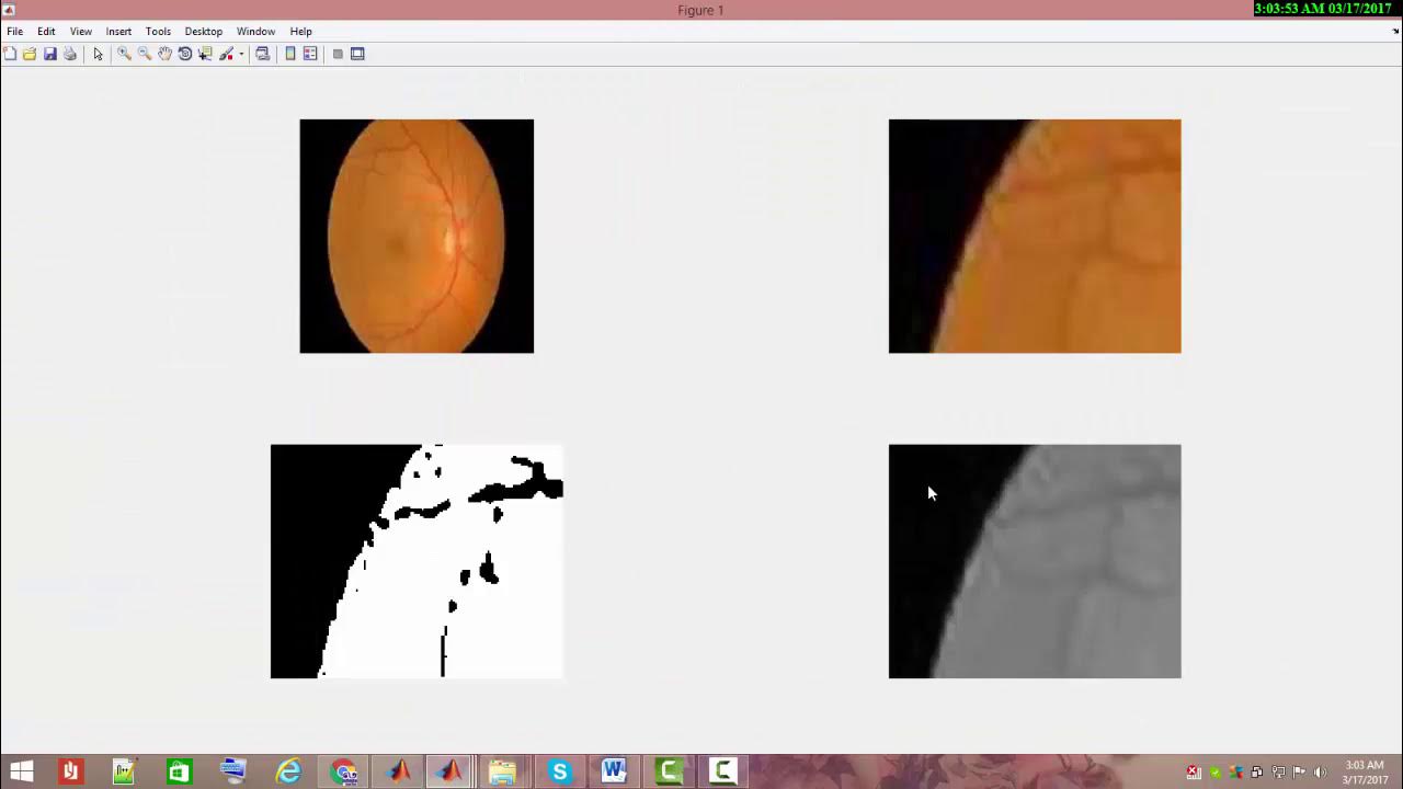 Diabetic Retinopathy Detection|+91-9872993883 for query| Neural Network ...