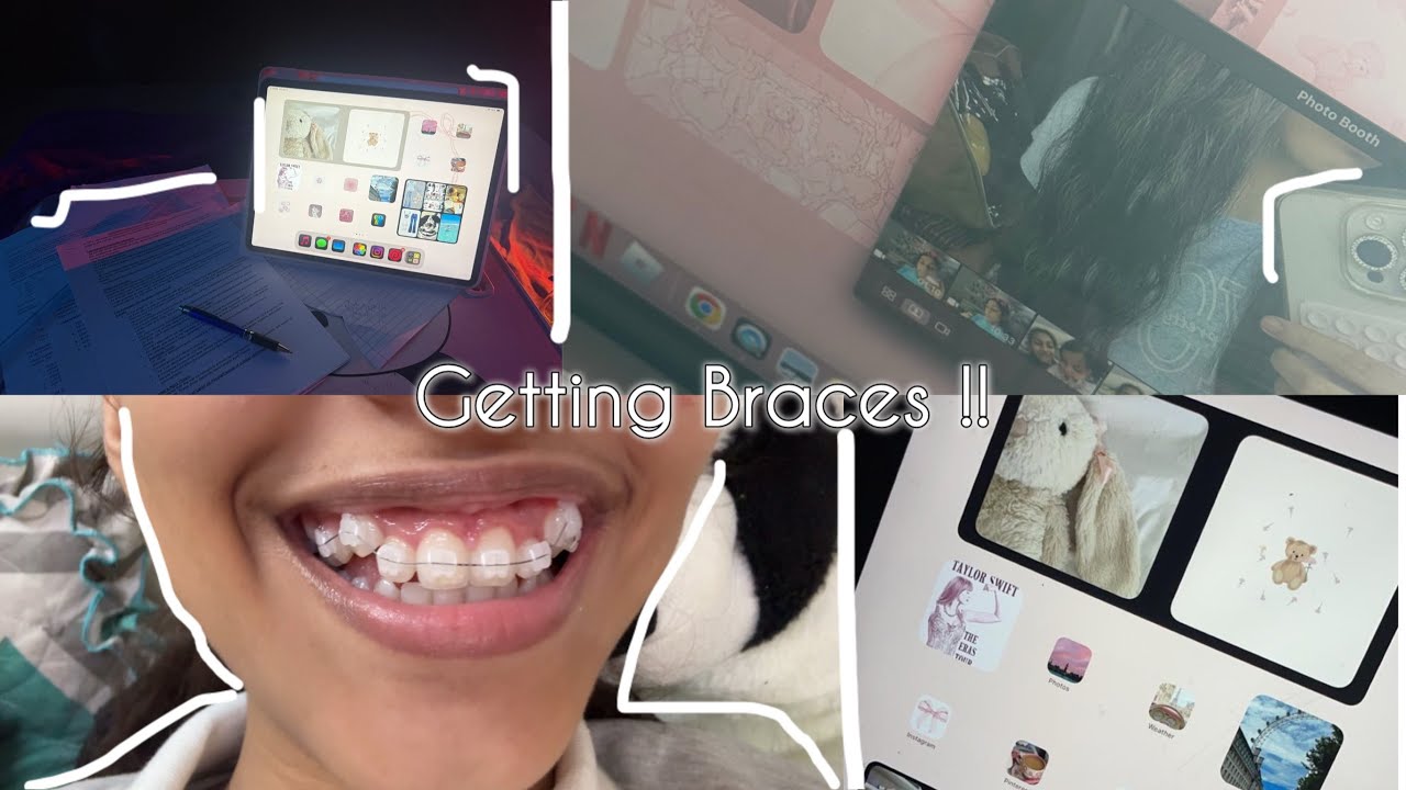 Getting braces 😅 🏻#braces #gettingbraces #vlog - YouTube