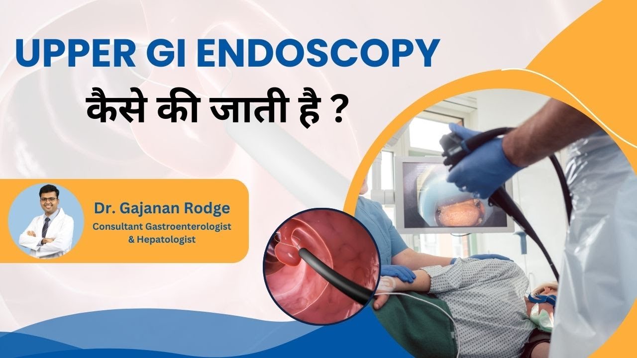 Upper GI Endoscopy कैसे की जाती है ? | Upper GI Endoscopy Explained ...