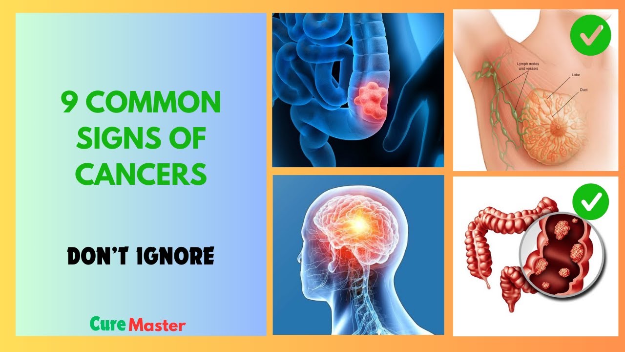 9 COMMON SIGNS OF CANCERS - YouTube