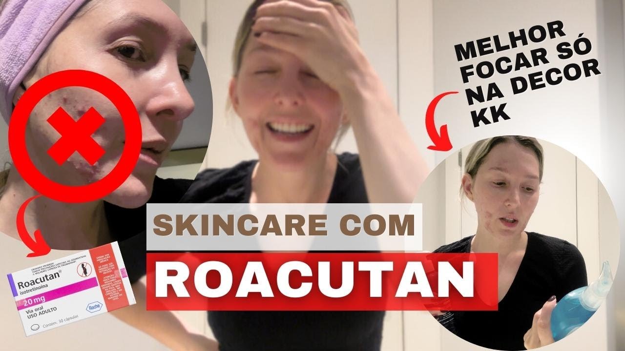 SKINCARE DURANTE A FASE DA PIORA DO ROACUTAN | Contém Decor - YouTube