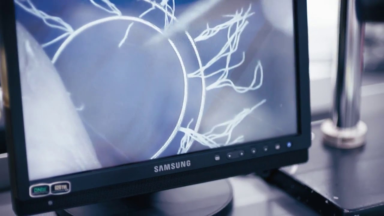 How it’s Made Interlock and IDC Detachable Coils - YouTube