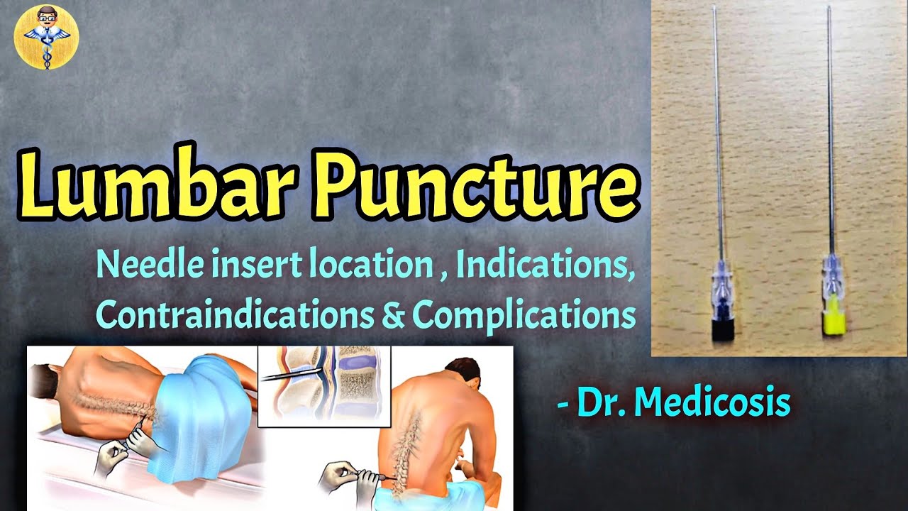 Lumbar Puncture | Location , Indication, Contraindications ...