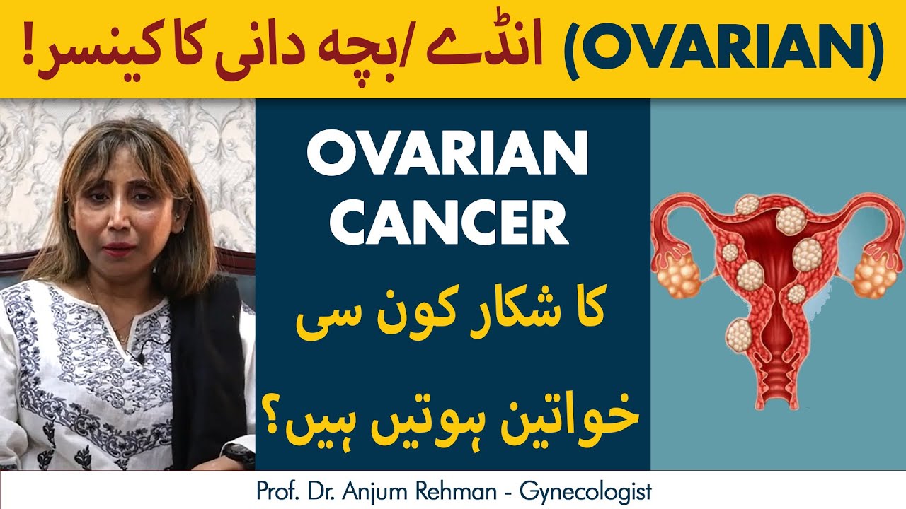 Ovarian Cancer Ki Almaat Aur Ilaj | Ande/ Bache Dani Ka Cancer | Dr ...