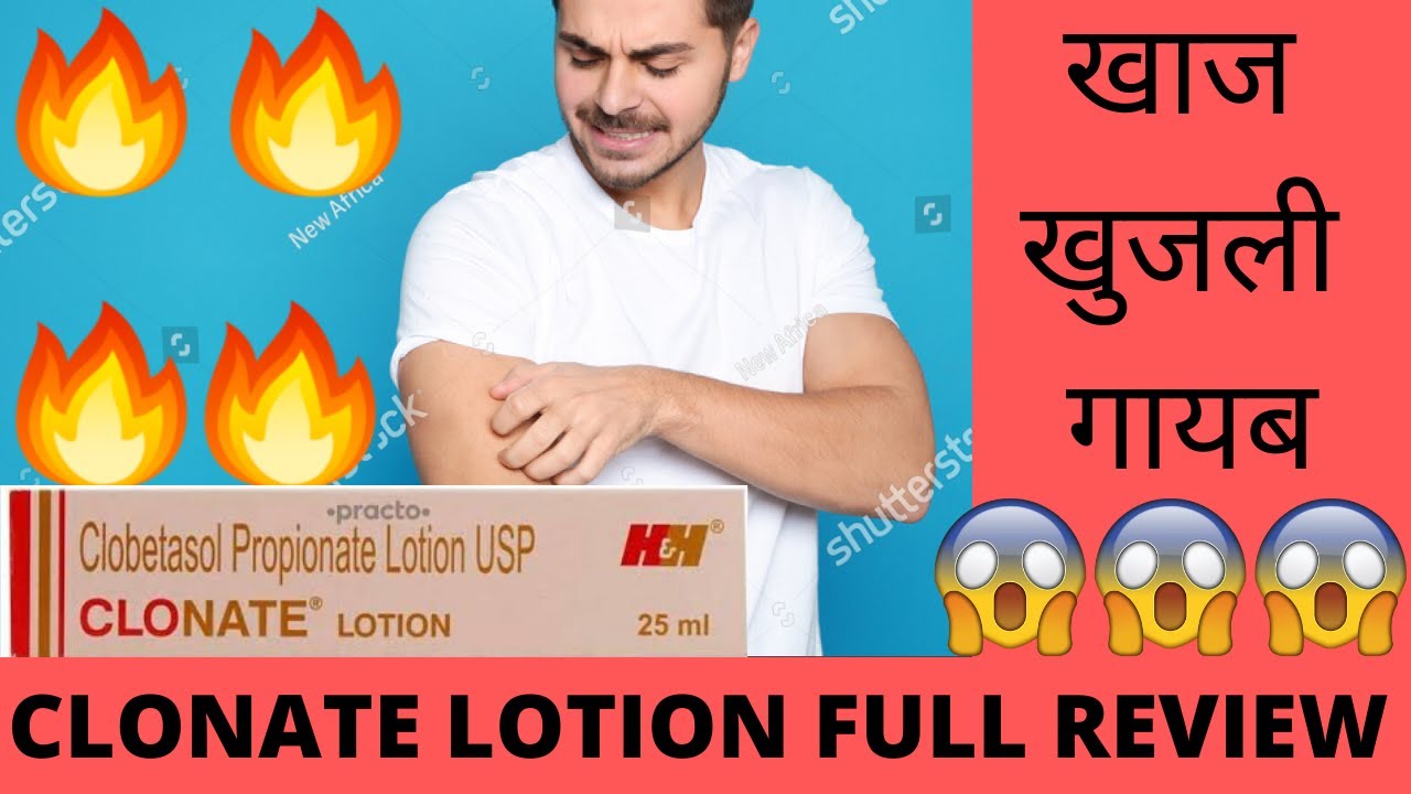Clonate Lotion Full Review Effect and Side Effect Best for Fungal ...