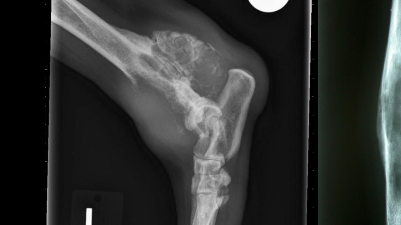 Osteomyelitis and Bone Tumors | Radiology of Skeleton System | Part 3 ...