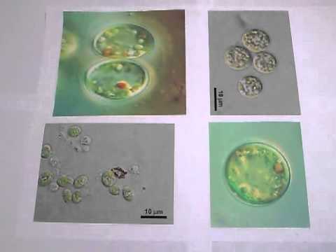 Caracteristicas de Eustigmatos - YouTube