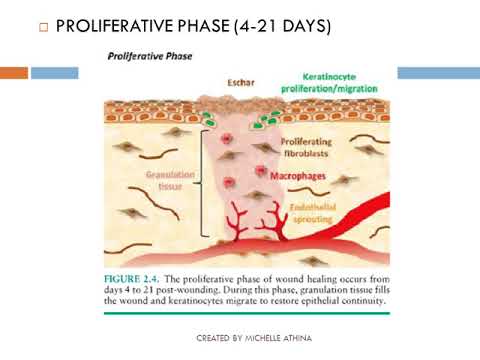 WOUND HEALING NORMAL AND ABNORMAL mov - YouTube