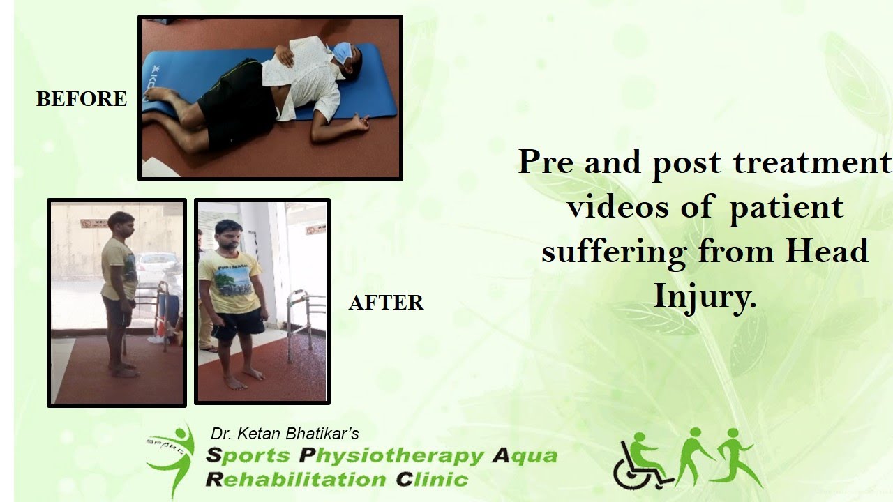 Treatment video of patient suffering from Post Head Injury. - YouTube