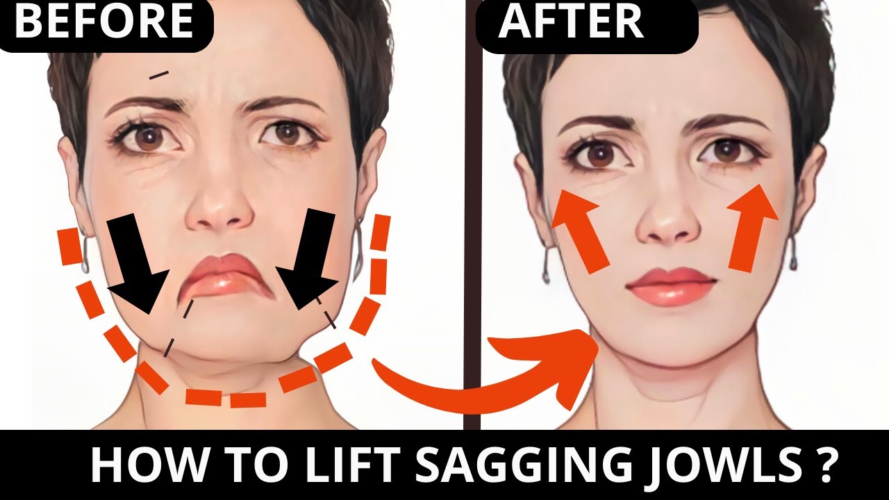 Lift Saggy Jowls in 2 Weeks! Face Exercises for Marionette Lines, Saggy ...