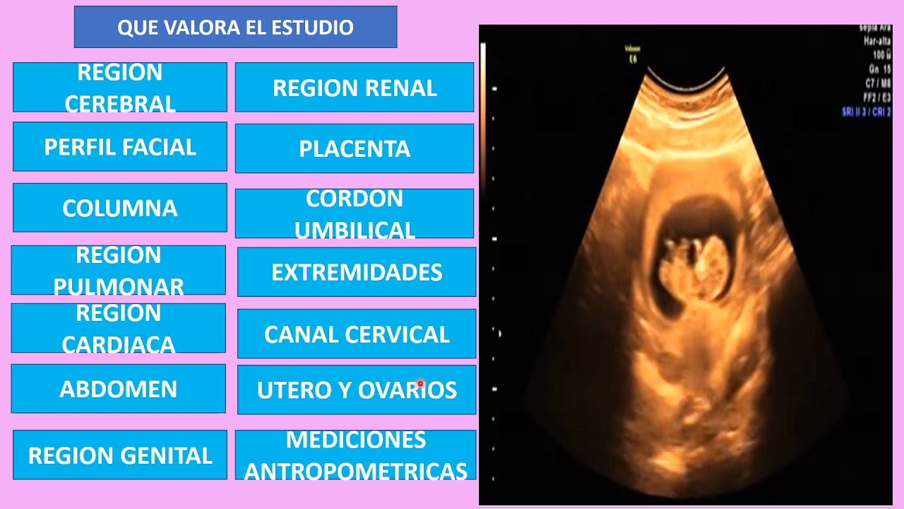 ULTRASONIDO OBSTETRICO ESTRUCTURAL - YouTube