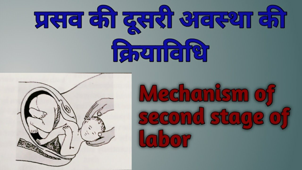 MECHANISM OF SECOND STAGE OF LABOR | Events in normal labor | ADVANCE ...