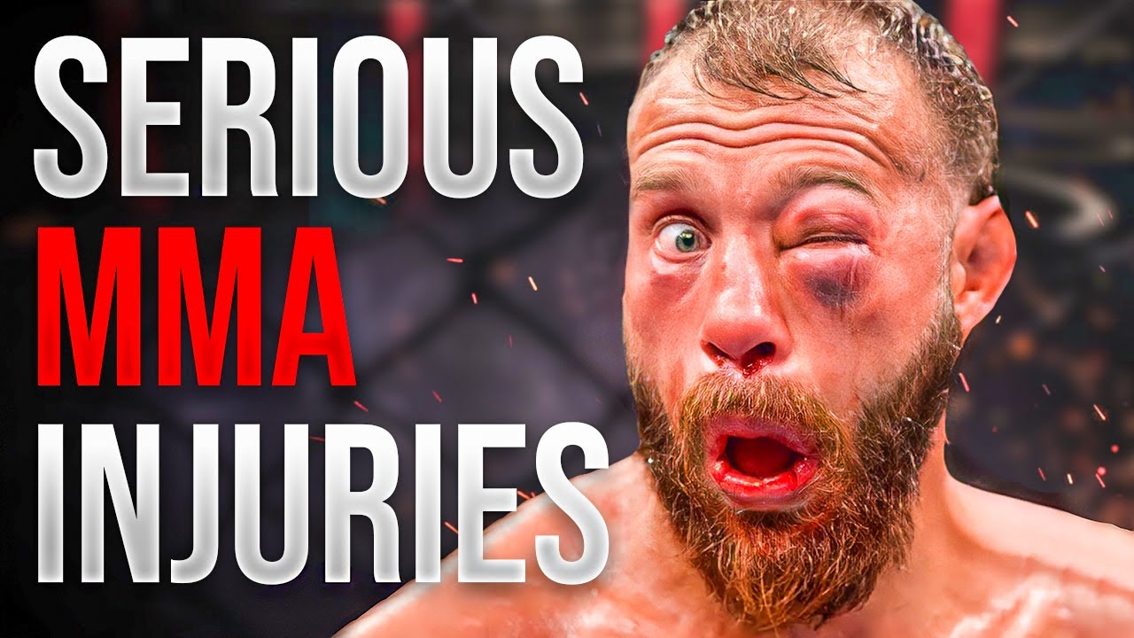 MMA Fighters Who Got SERIOUS Injuries REVEALED! - YouTube