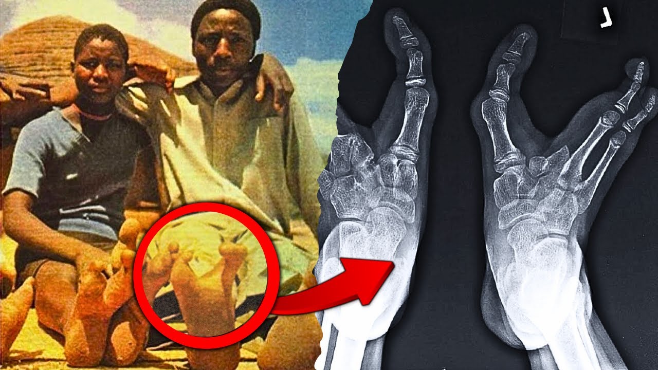 Zimbabwe Tribe With Two Toed Ostrich Feet - YouTube