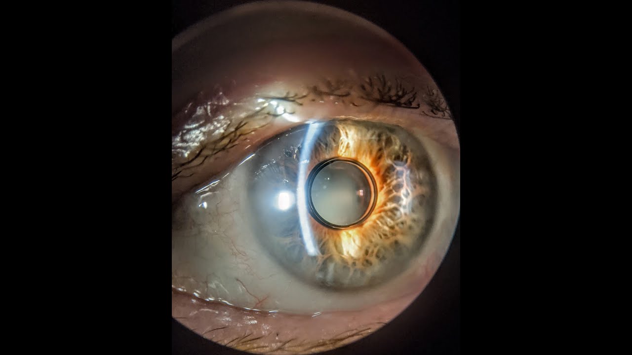 Samsara Vision Patient Journey - YouTube