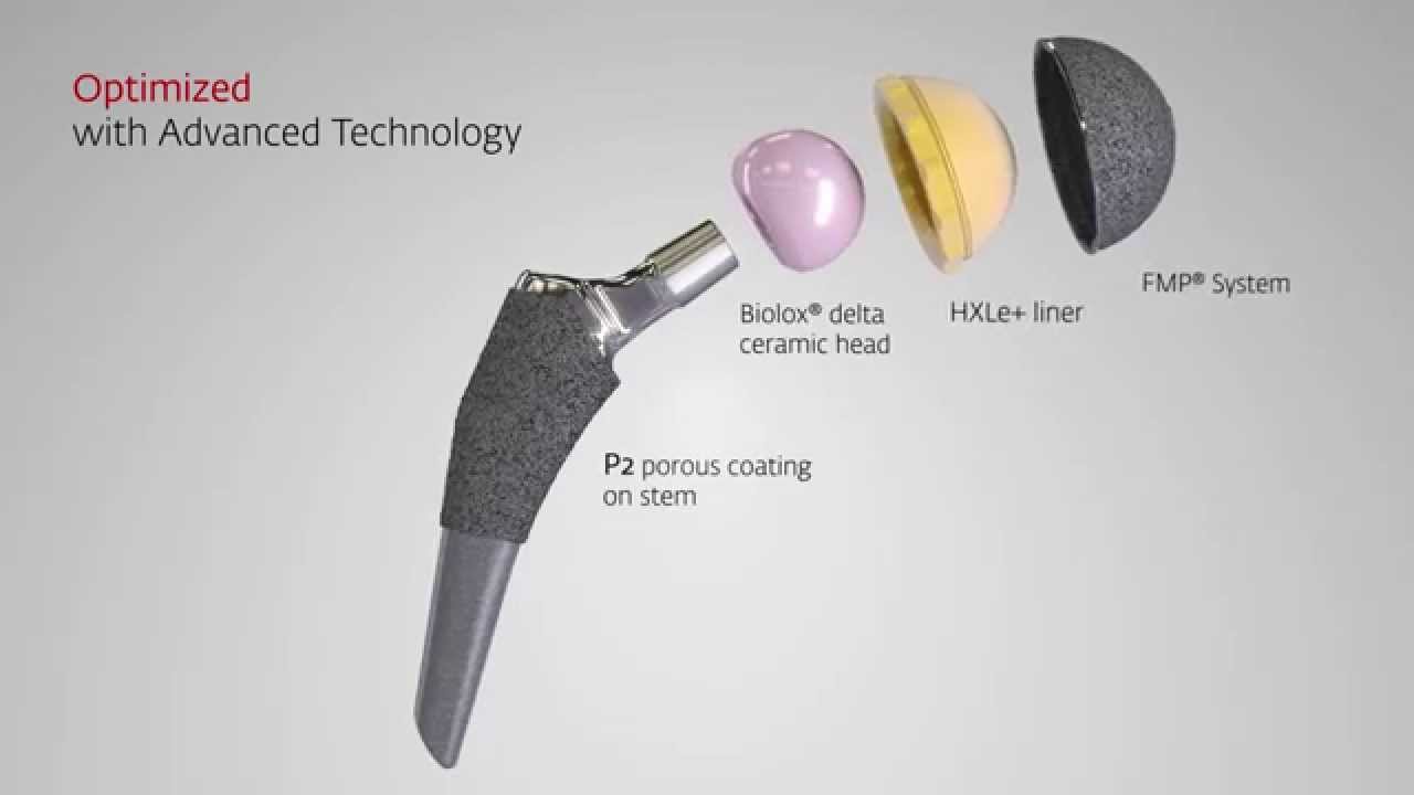 DJO Surgical - Taperfill™ Hip System - YouTube