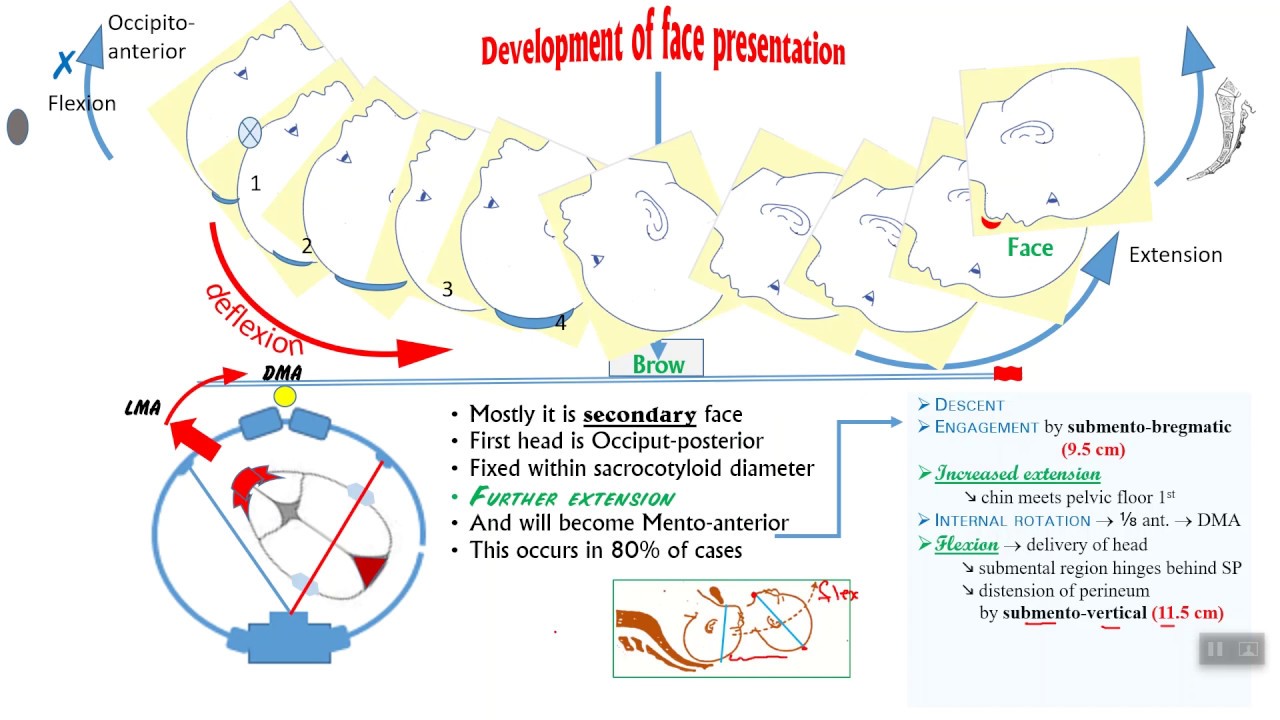 OP vs face (part 2) - YouTube