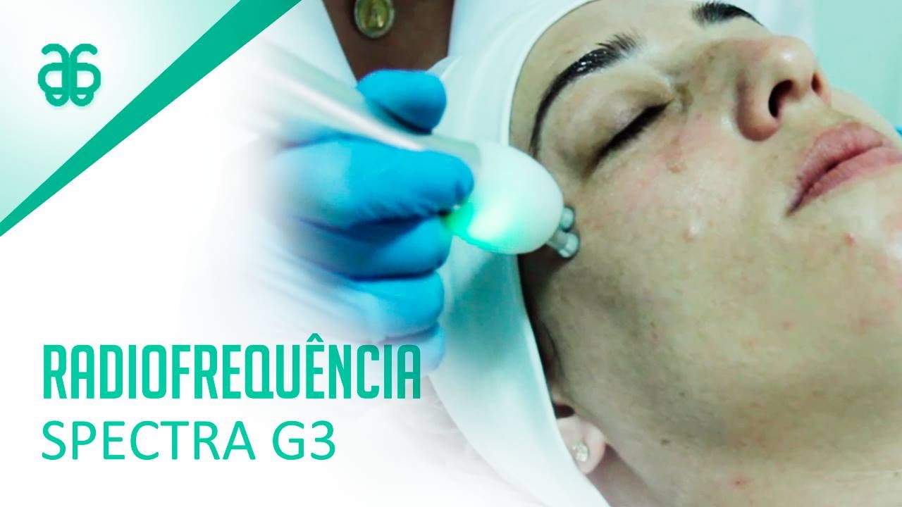 Radiofrequência - Spectra G3 - YouTube