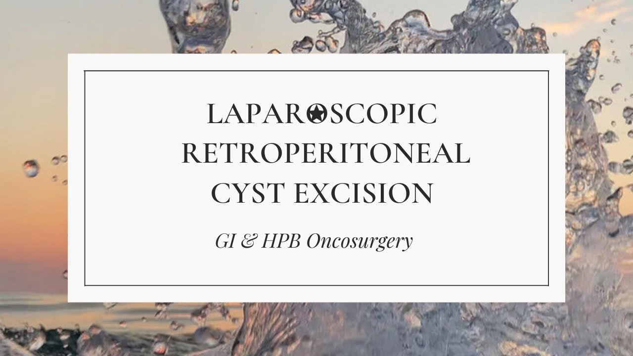Laparoscopic Retroperitoneal Cyst Excision - YouTube