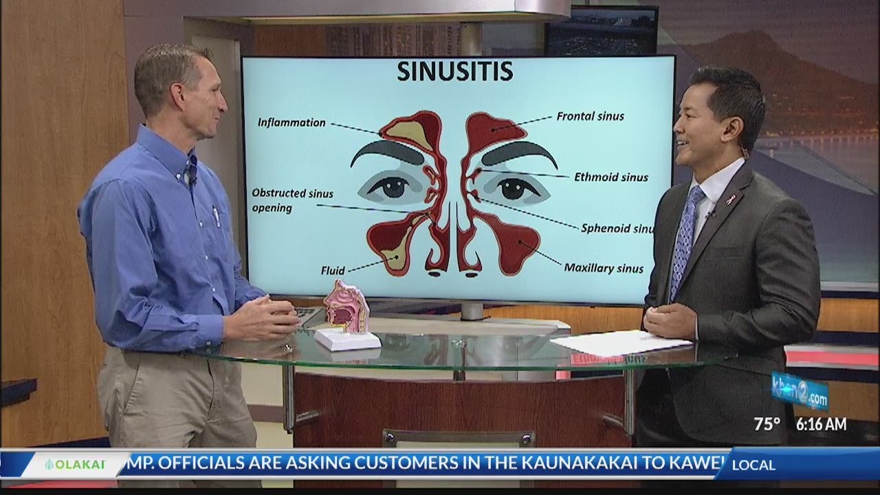 Sinusitis vs. The Common Cold - The Queen's Medical Center - Ask a ...