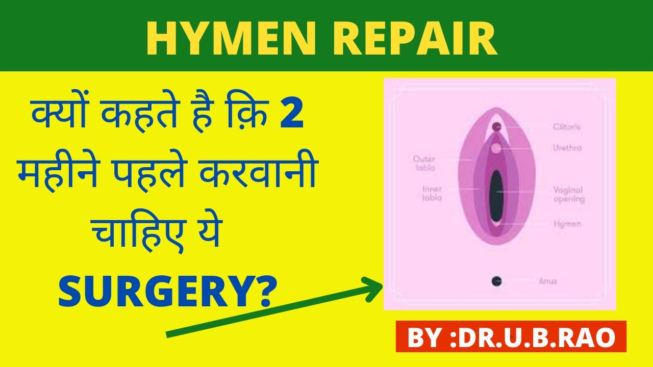 Hymen Repair. Do's and Dont's . सभी सवालों के जवाब ( Myths Busted ...