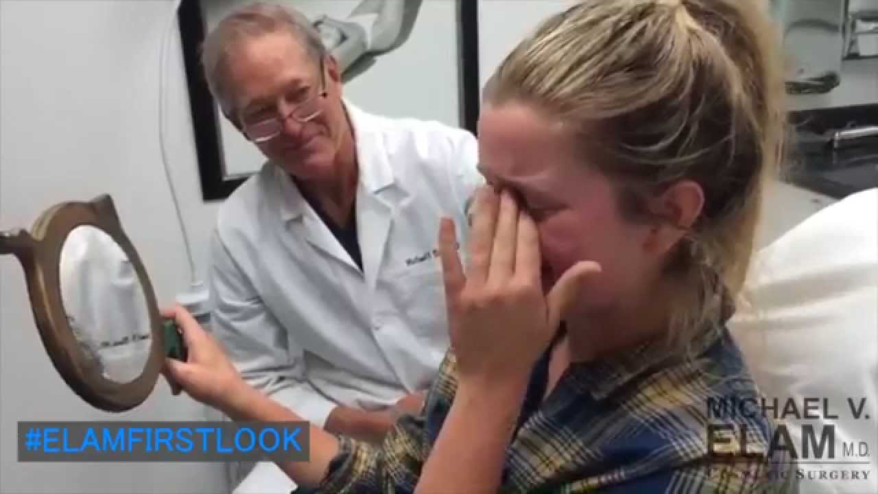 Miraculous! Amazing Rhinoplasty Reveal by Dr. Michael Elam # ...